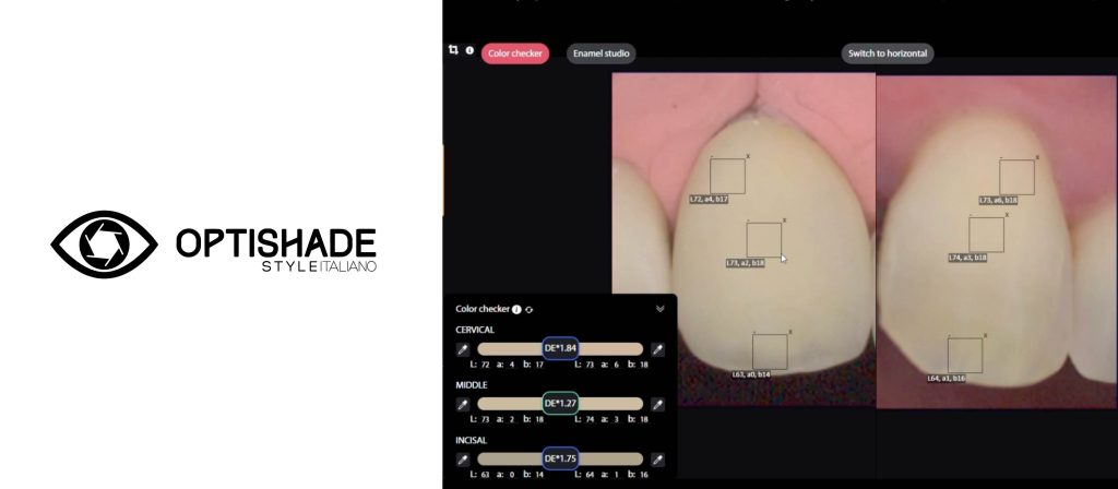 OptiShade - Tips & Tricks - modern-dental-europe.com