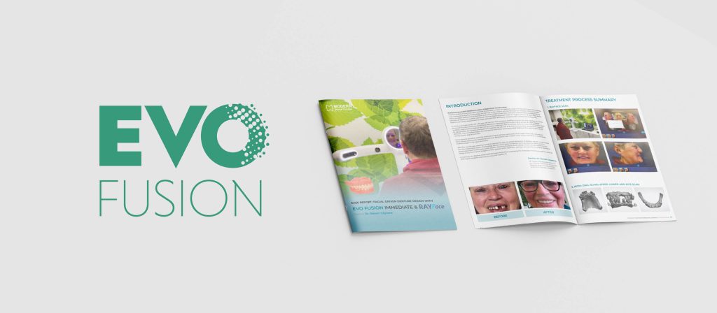 A Digital Smile Transformation with RAYFace - modern-dental-europe.com