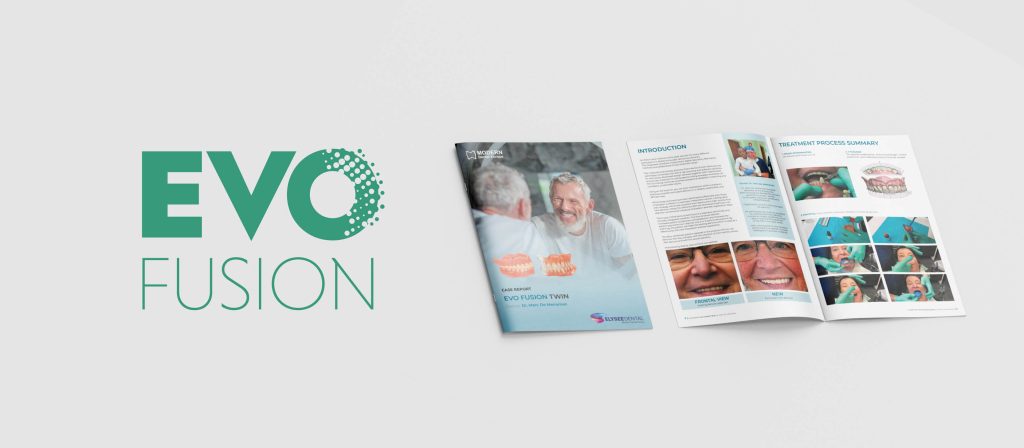 Skip conventional individual impression with EVO Fusion TWIN - modern ...